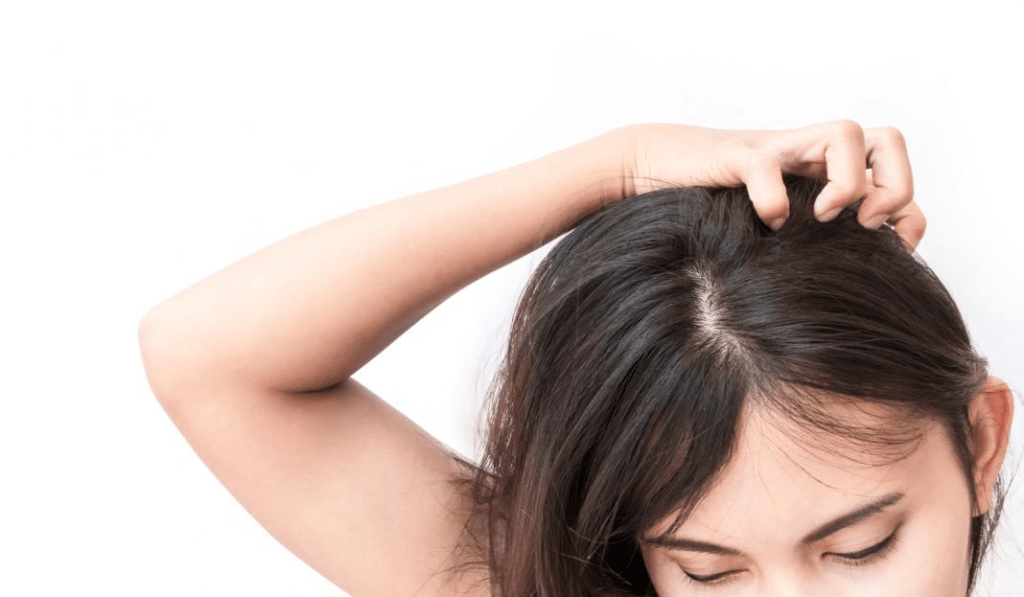The Elusive Nits and How to Catch Them - Lice Busters USA